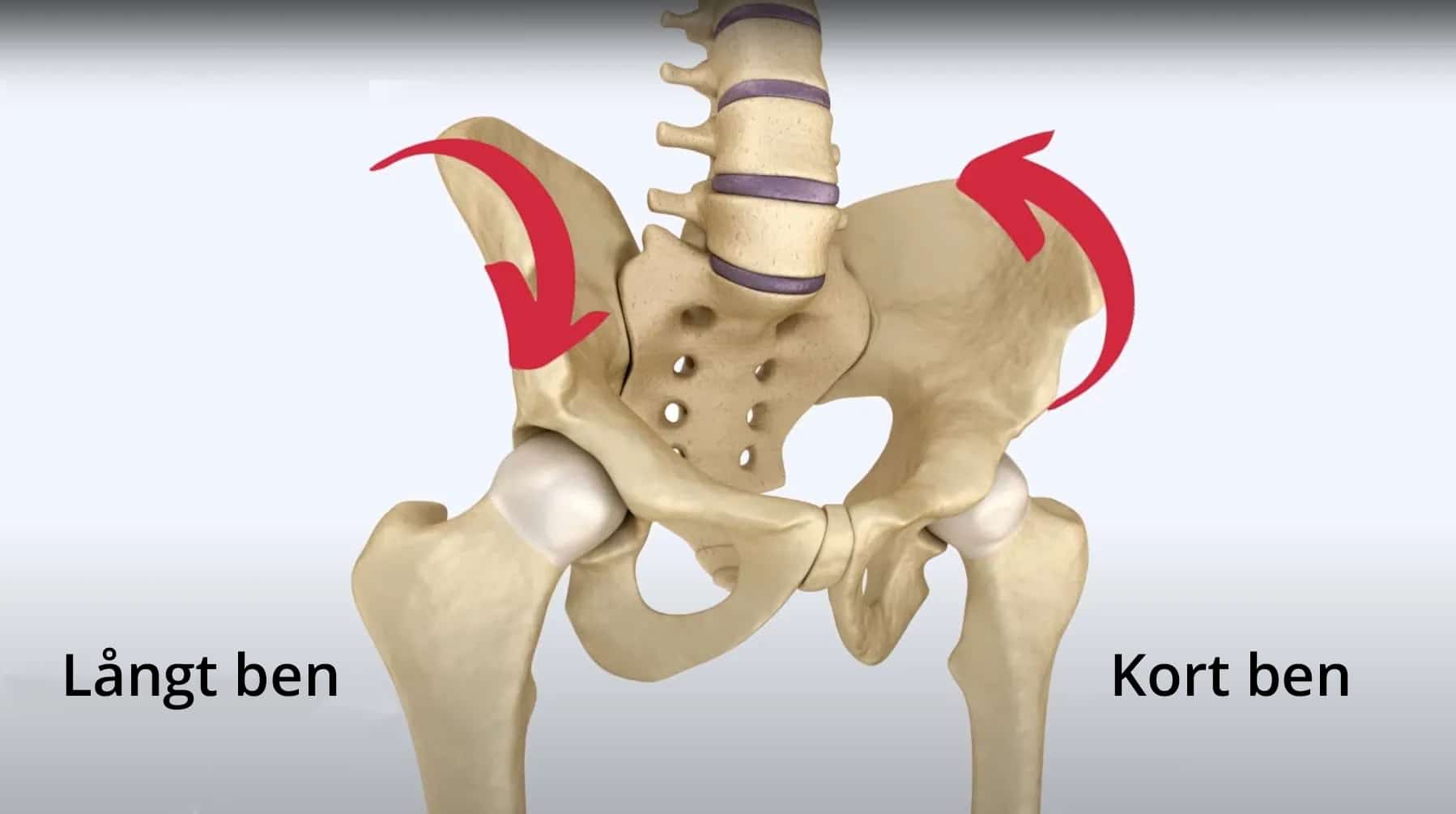 SI-leden - Den vanligaste orsaken till smärta i bäckenets baksida